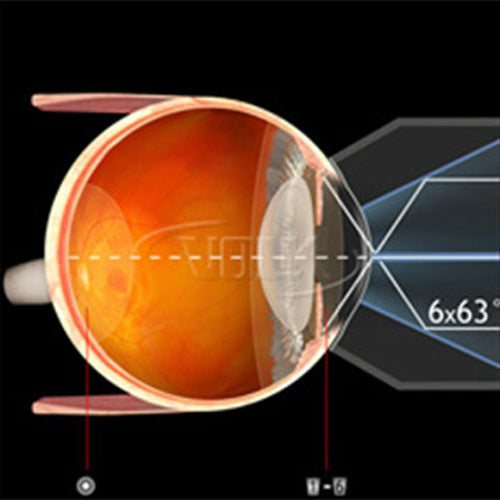 Volk Student VG6LNF 6-Mirror Gonio Lens – Marco Lombart Student Portal